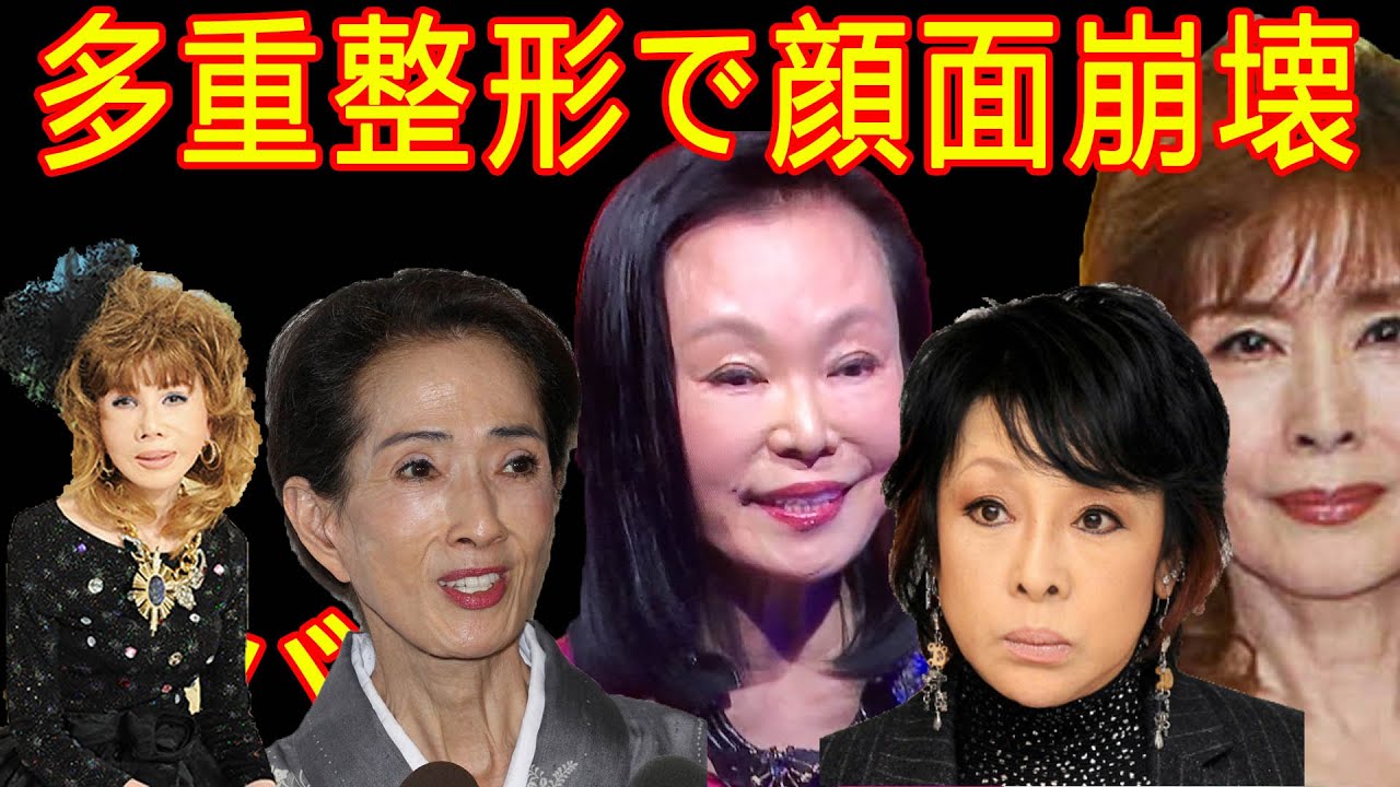 多重整形で顔面崩壊した女性芸能人12選【※ヤバい画像・衝撃現在】 Magmoe