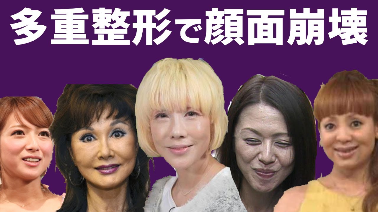 多重整形で顔面崩壊した女性芸能人【ヤバい画像・衝撃現在】 Magmoe