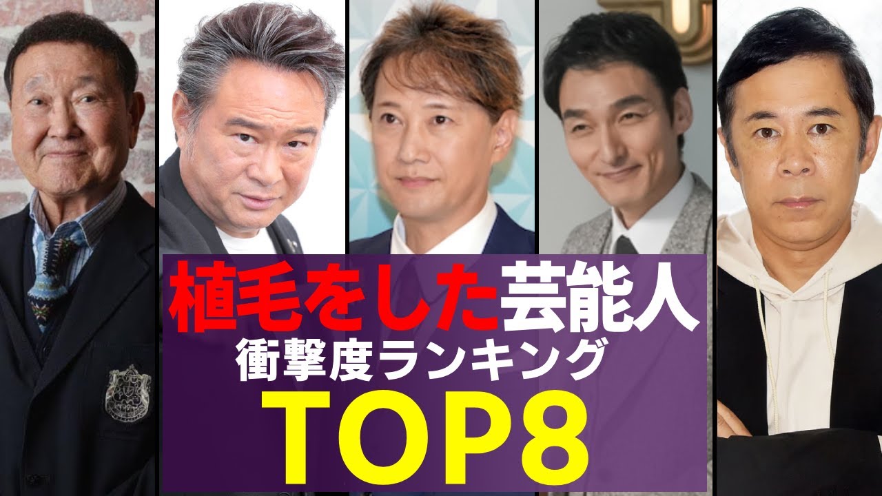 植毛でハゲを隠した有名人 衝撃度ランキングTOP8 - MAGMOE