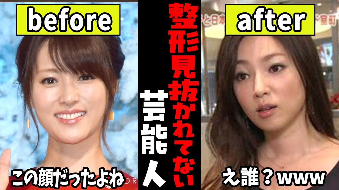 【ガルちゃん芸能】やっぱりか...見抜かれていない整形した芸能人【有益2ch】 - MAGMOE