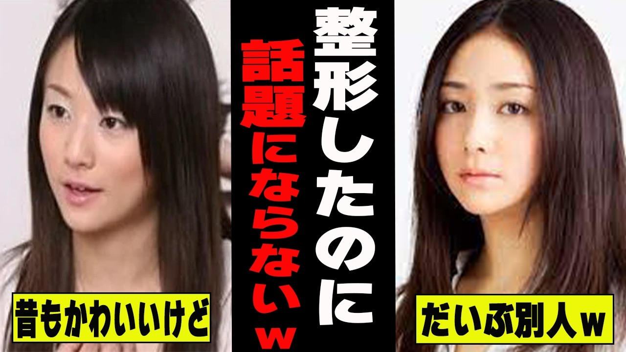 【がるちゃん芸能人】整形が話題にならない芸能人 w - MAGMOE