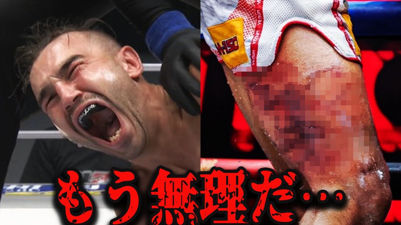 【衝撃】戦慄のキックKO！痛すぎて地獄・・・【格闘技/k1】 - MAGMOE
